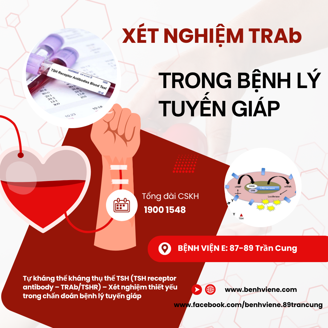 Xét nghiệm TRAb là gì?
